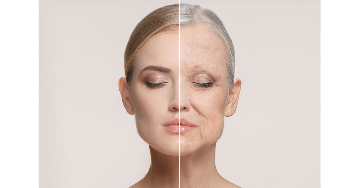 The Aging Process in the Upper Face - Guidebyday